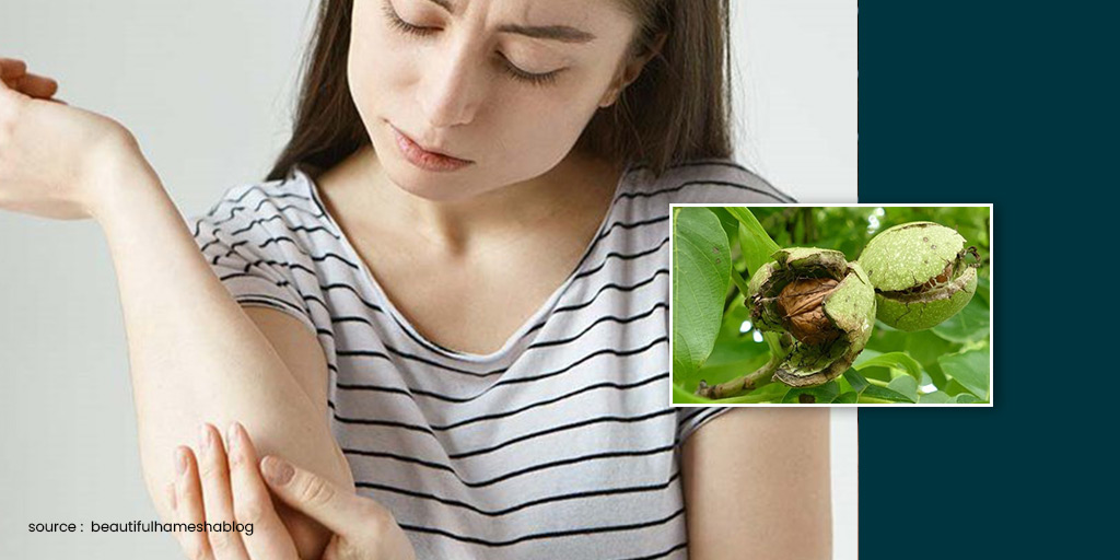Home Remedies To Get Rid Of Crack And Dry Elbow | फटी और रूखी कोहनी से ...