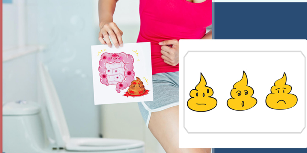 Having Yellow Stools? Find Out The 5 Possible Reasons Behind It ...