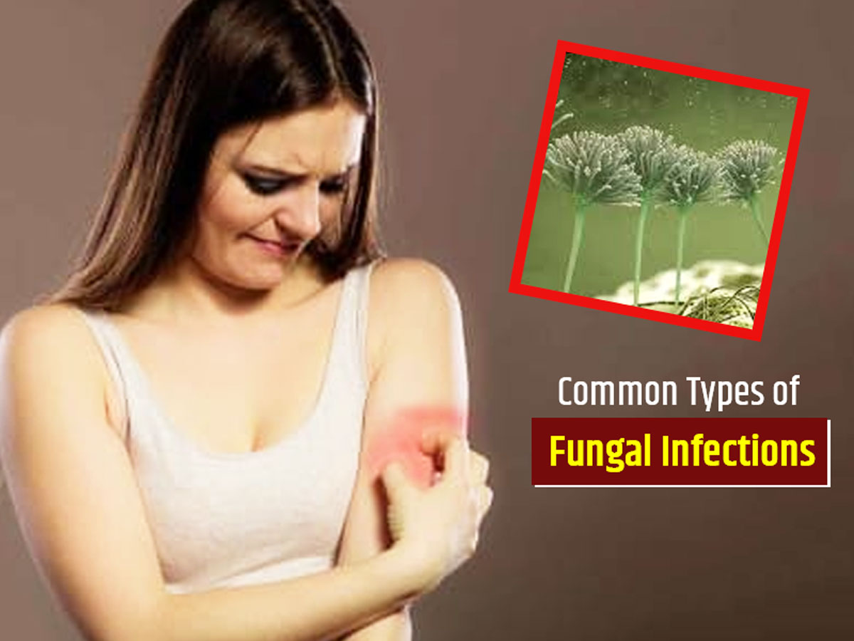 Female Yeast Infection Rash