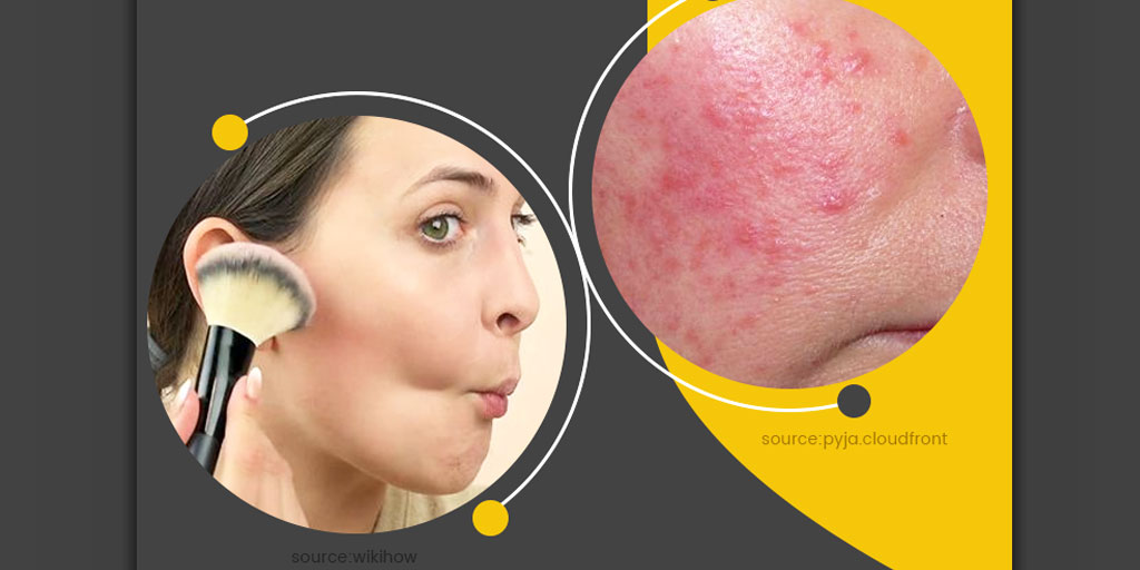 Home Remedies To Cure Infection From Makeup Products | मेकअप उत्पादों ...