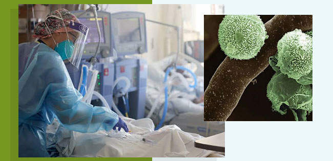 Green Fungus: Symptoms, Causes, Treatment, Prevention | Onlymyhealth