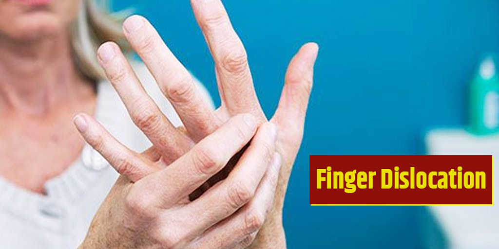 Finger Dislocation: Know Symptoms, Causes, Diagnosis & Ways To Treat It ...