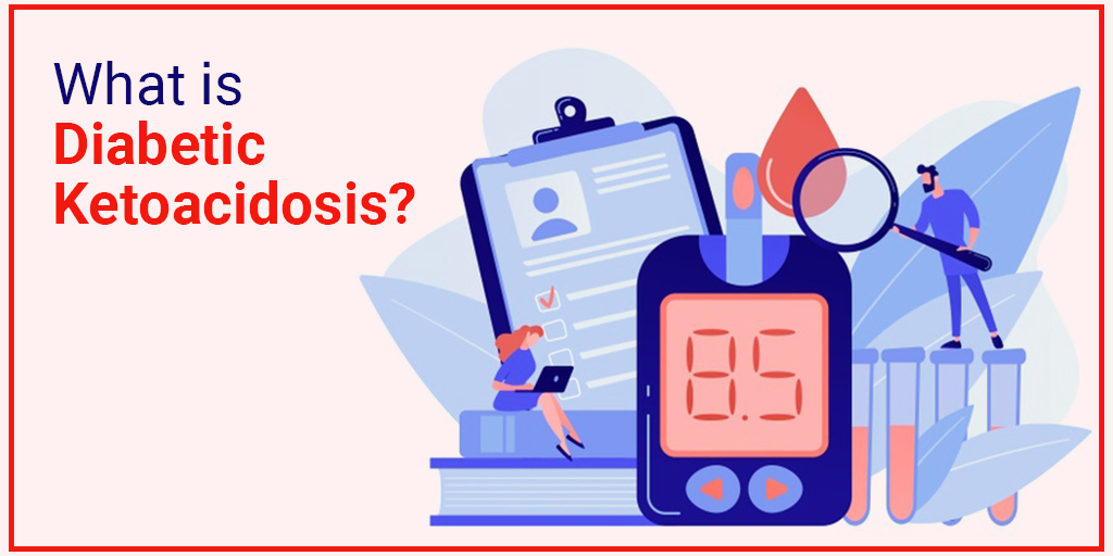 What Is Diabetic Ketoacidosis? Signs, Causes, Treatment & Prevention ...