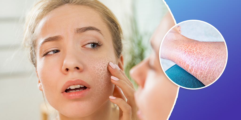Fish Scales On Skin Due To Dryness Prevention Tips From Exper fish-scales-on-skin-due-to-dryness-prevention-tips-from-exper