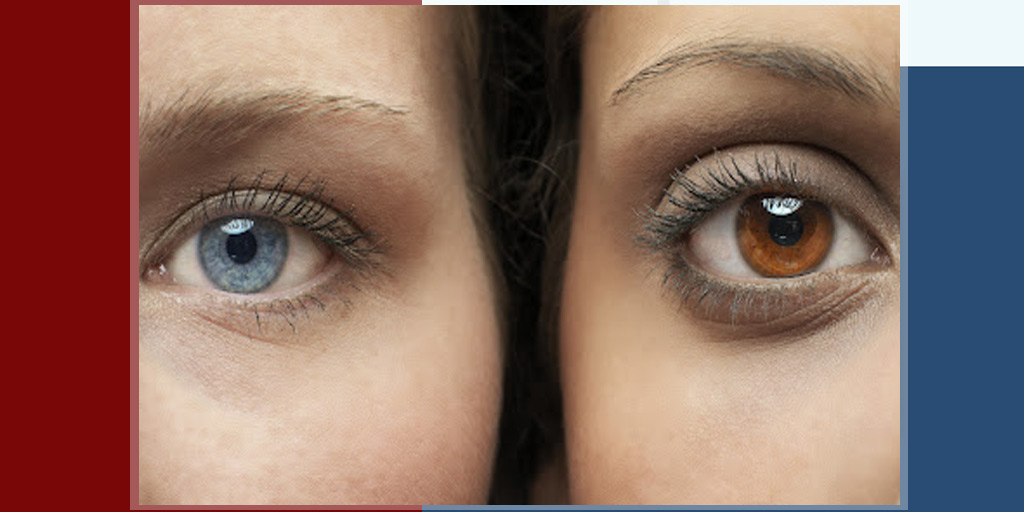 Expert Explains The Reason Behind Different Eye Colours And Its Causes ...