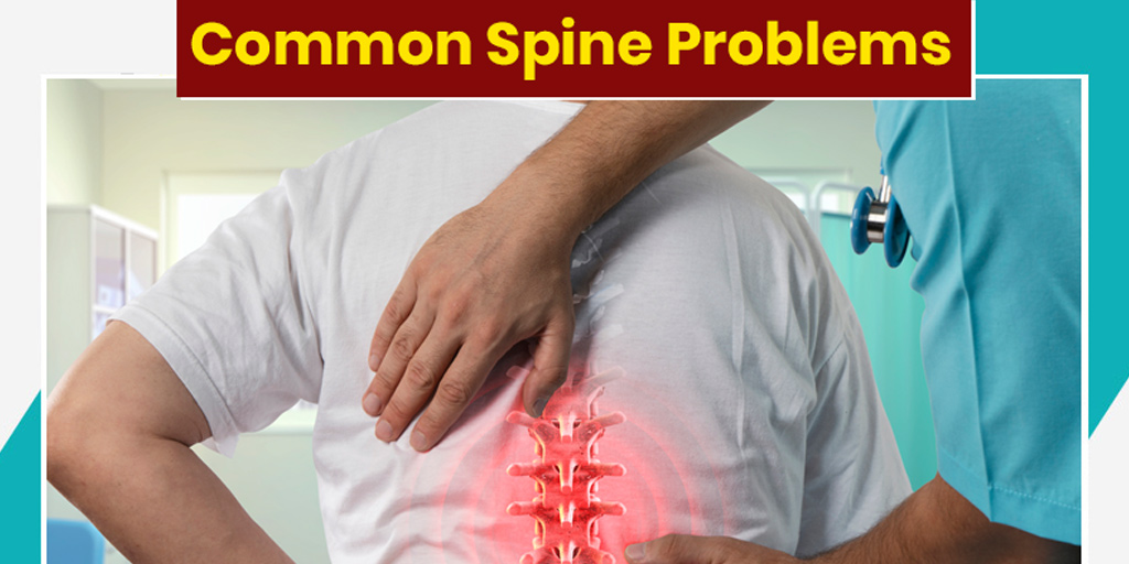7 Common Spine Issues That Can Happen To Anyone, Know How To Cope Up ...