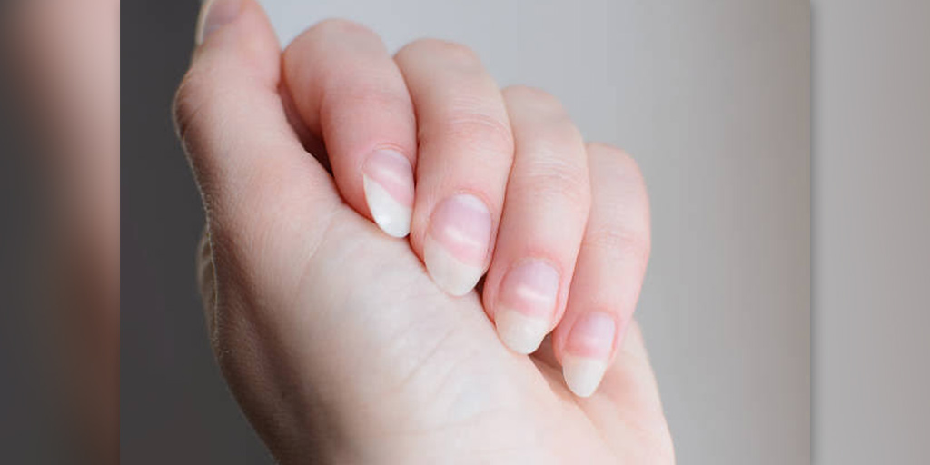 Calcium Deficiency Leads To Muscle Spasms? Know The Causes, Symptoms ...