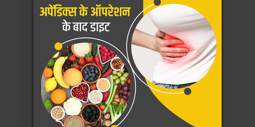 Diet after appendix surgery in hindi | अपेंडिक्स का ऑपरेशन होने के बाद ...