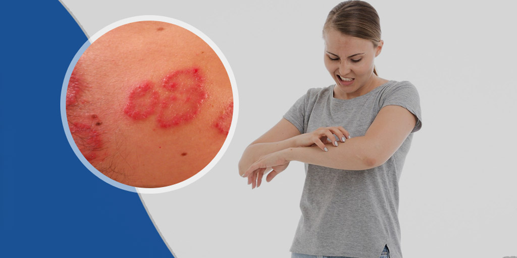 What Causes Allergies: Risk Factor, Complications, Preventive Tips ...