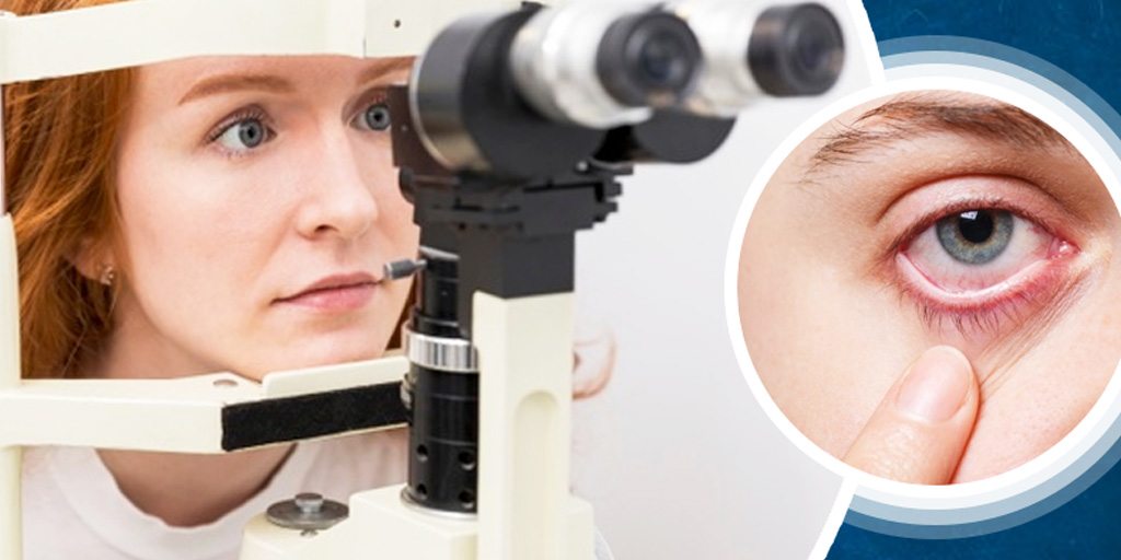 5 Corneal Diseases That Can Cause Serious Damage To Your Eyes ...