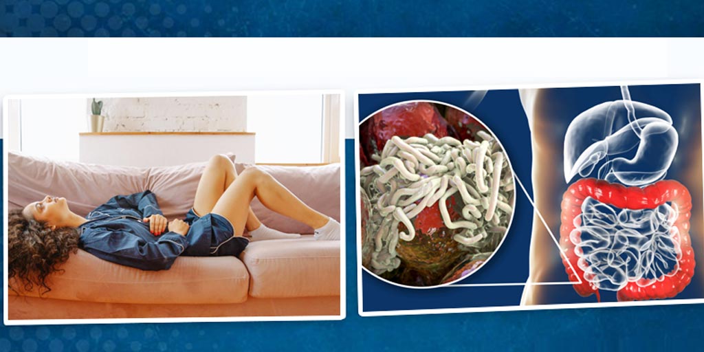 Whipworm Infection: All You Need To Know About This Parasitic Infection ...