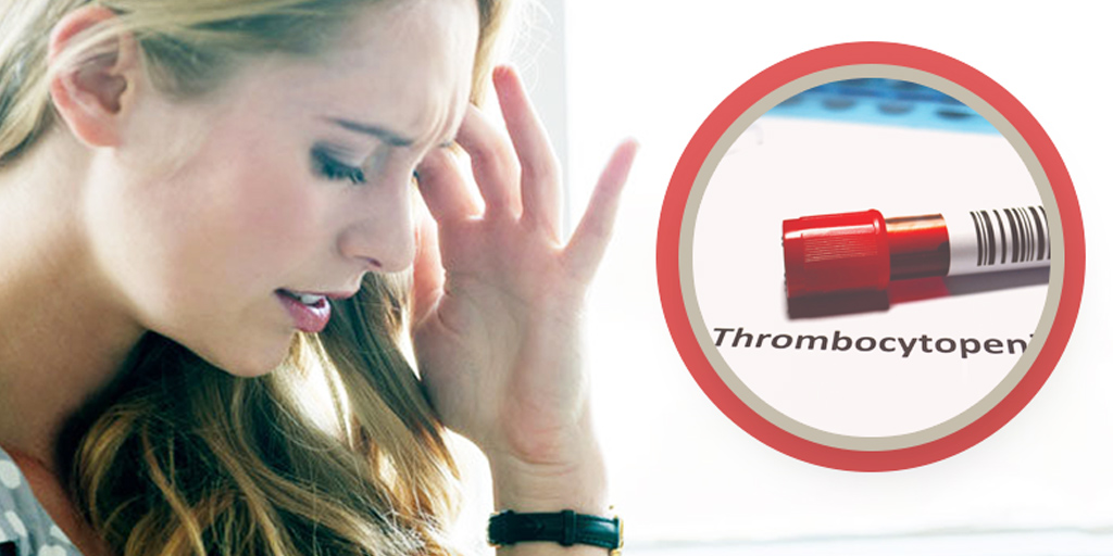 Platelet Deficiency: Symptoms And Causes To Prevent Adversity ...