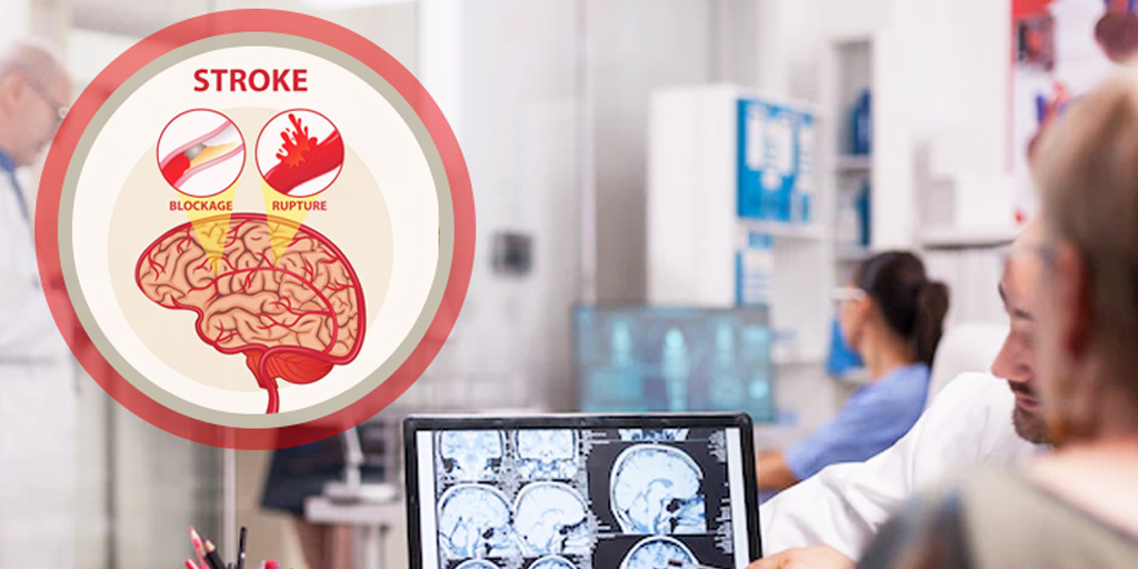 What Is The Golden Hour For Stroke Patients - What Is The Golden Hour ... What Is The Golden Hour For Stroke Patients - What Is The Golden Hour ...