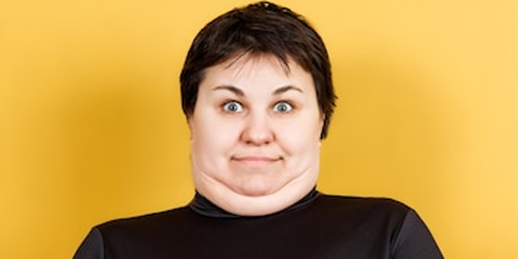 How To Reduce Double Chin At Home |Exercise | Onlymyhealth