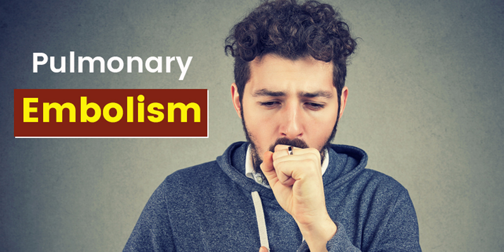 Pulmonary Embolism Meaning| Symptoms Risk Factors Causes | Onlymyhealth