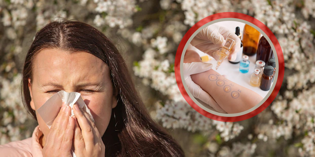 How Allergy Test Is Done- Types and Importance | Onlymyhealth