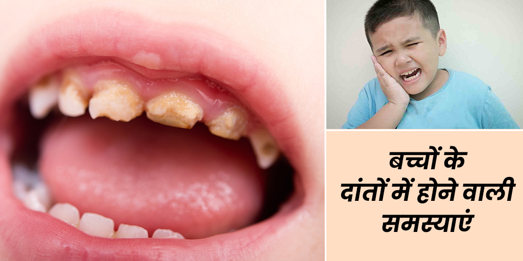 Dental Problems In Kids Side Effects In Hindi Dental Problems In Kids Side Effects In Hindi
