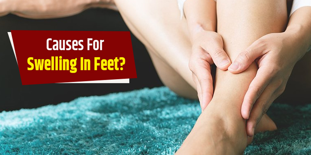 Swelling In Feet And Ankle: Know Causes From An Expert | Onlymyhealth