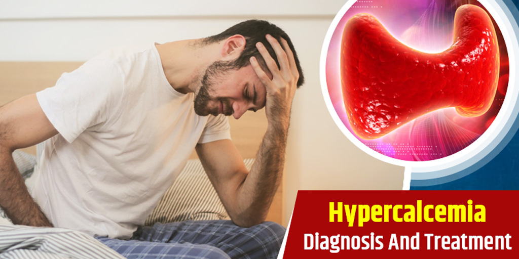 What Is Hypercalcemia Or High Calcium? Know Its Diagnosis And Treatment ...