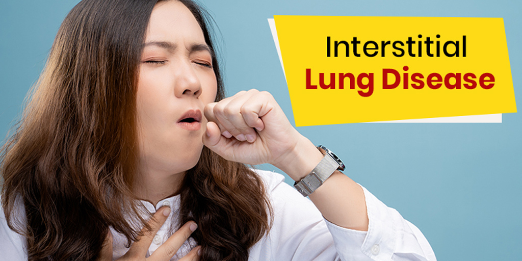 Interstitial Lung Disease Meaning Symptoms | Onlymyhealth