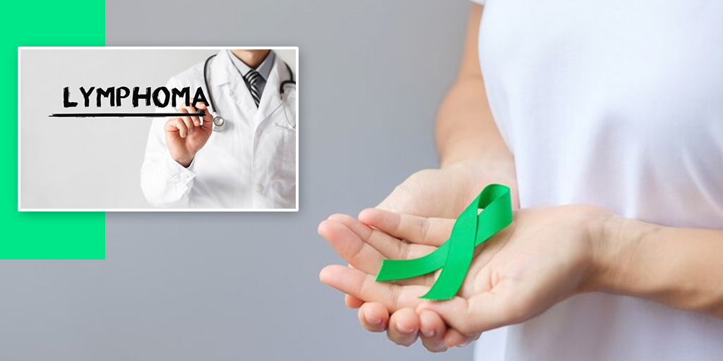 Lymphoma Cancer: Causes, Symptoms and Treatment