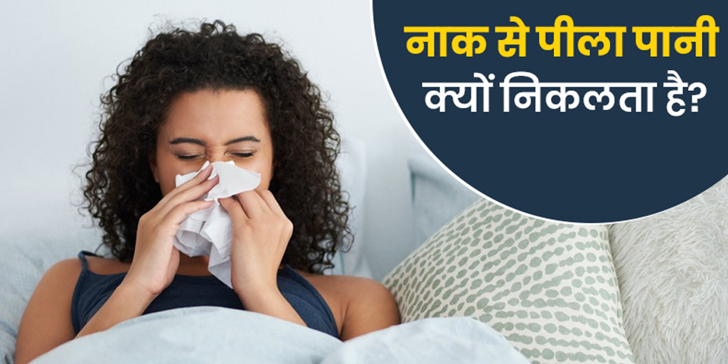 Yellow Mucus From Nose Causes Treatment | नाक से पीला पानी क्‍यों न ...
