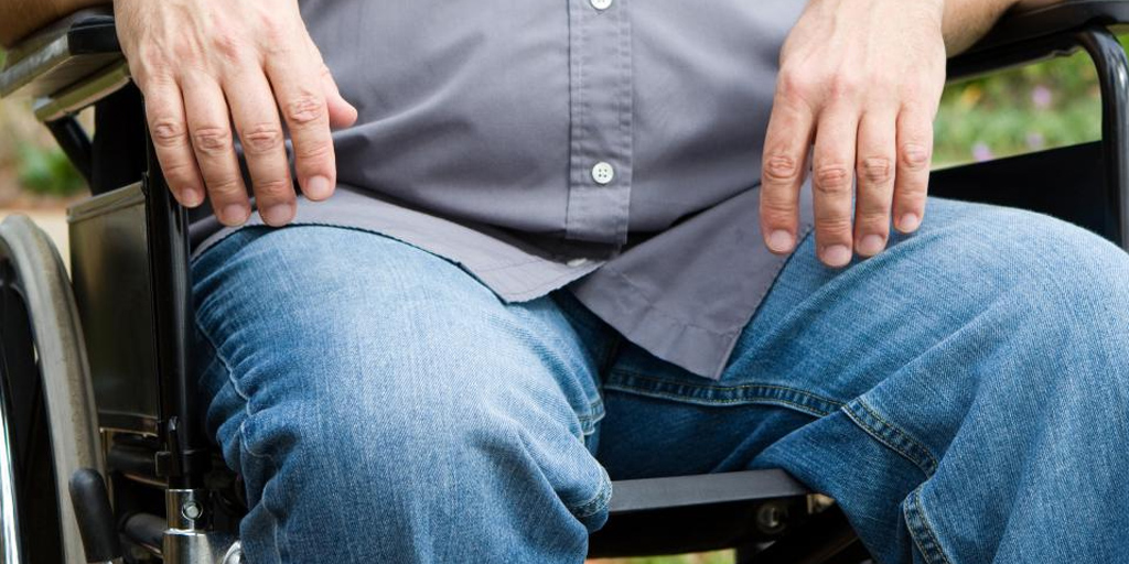 Fibrodysplasia Or Stoneman Syndrome: Know All About It - Fibrodysplasia ...