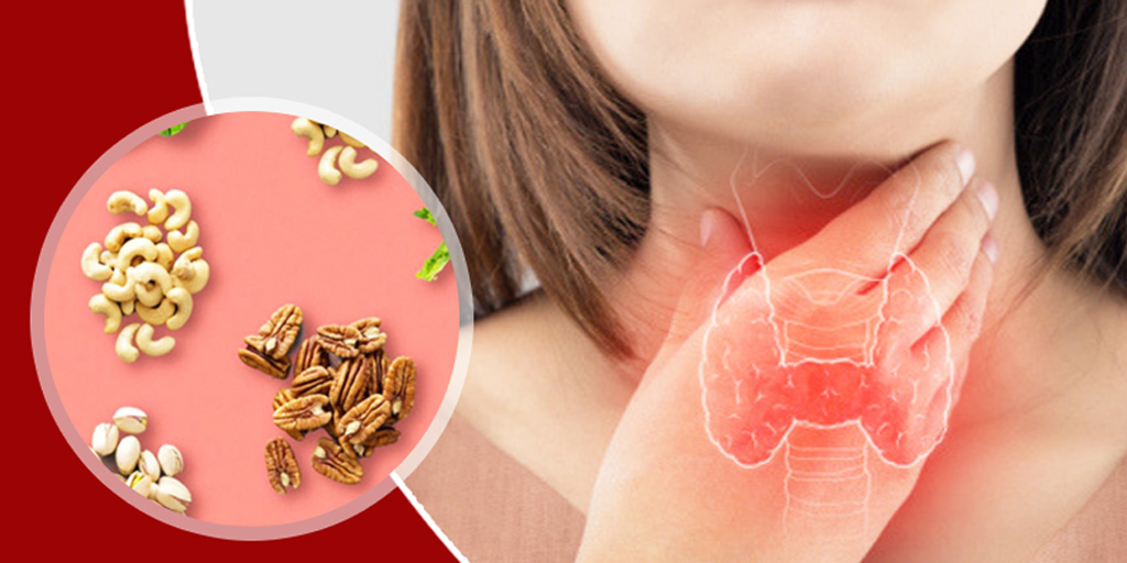 Typhoid Diet: Do’s And Don’ts For Recovery From Typhoid | Onlymyhealth