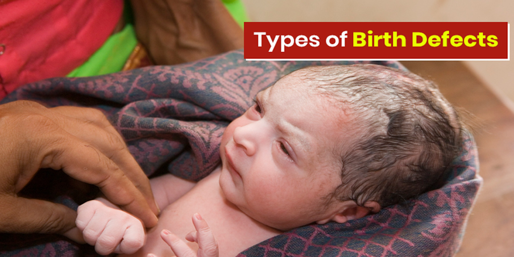 7 Types of Birth Defects: Symptoms And Treatment For Newborn | Onlymyhealth