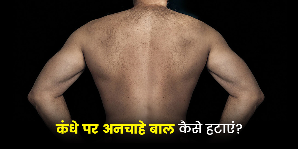 How To Get Rid Of Unwanted Hair On Shoulder | कंधे पर अनचाहे बालों से ...