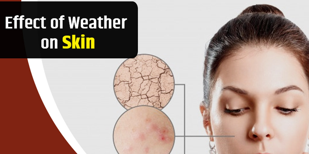 Do You Know How Weather Affects Skin? Refer To This Article | Onlymyhealth