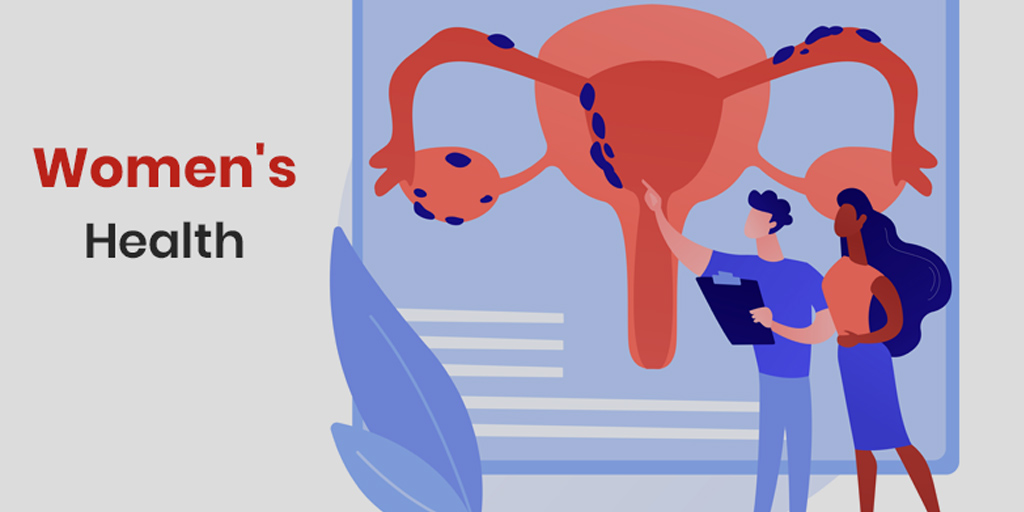 Women's Health: Endometriosis & Ovarian Cancer Genetically Linked, Says ...