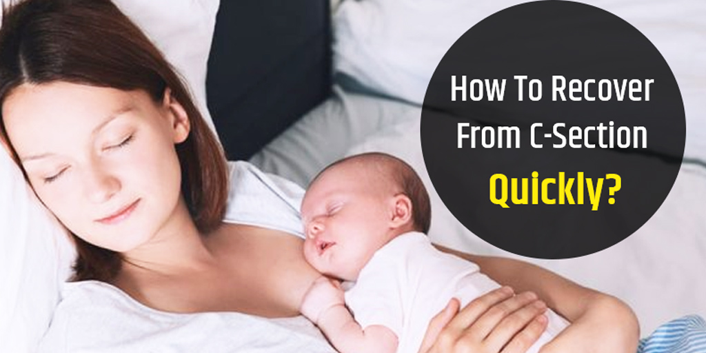 C-Section Recovery Tips - How To Quickly Recover From C-Section?