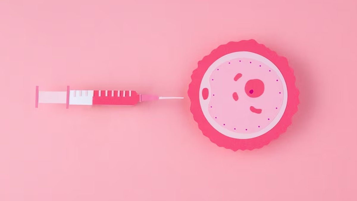 Intrauterine Insemination Expert Explains The Advancements And