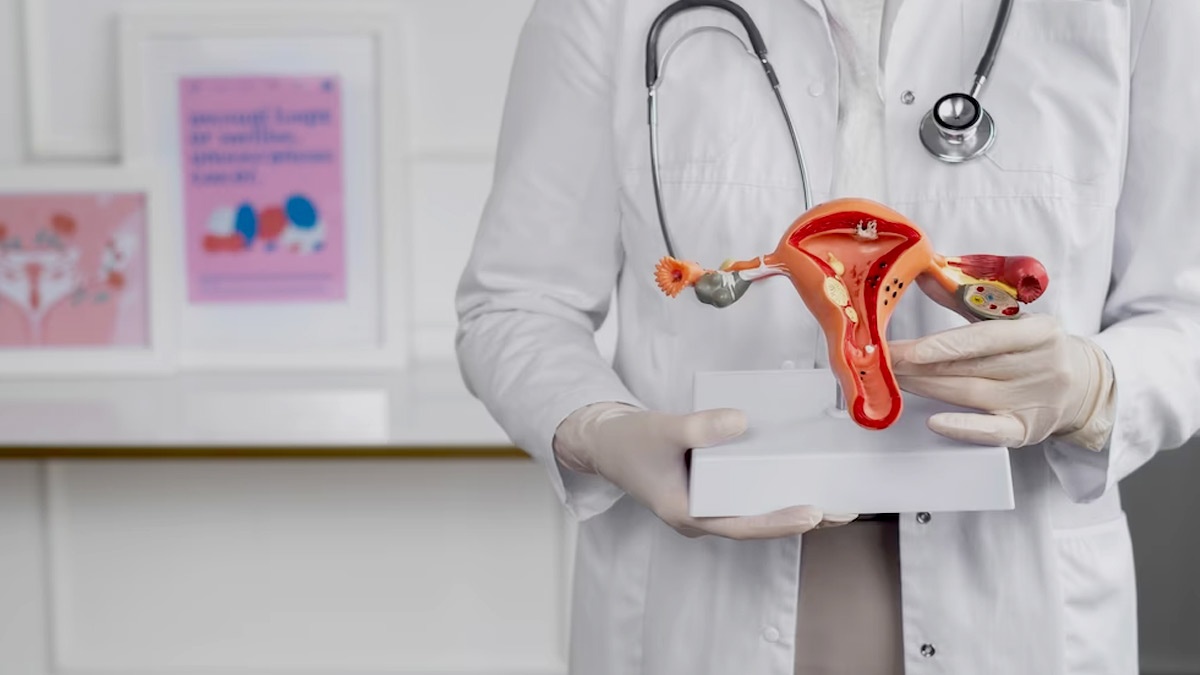 Uterine Cancer 7 Early Signs That One Must Know OnlyMyHealth Uterine Cancer 7 Early Signs That One Must Know OnlyMyHealth