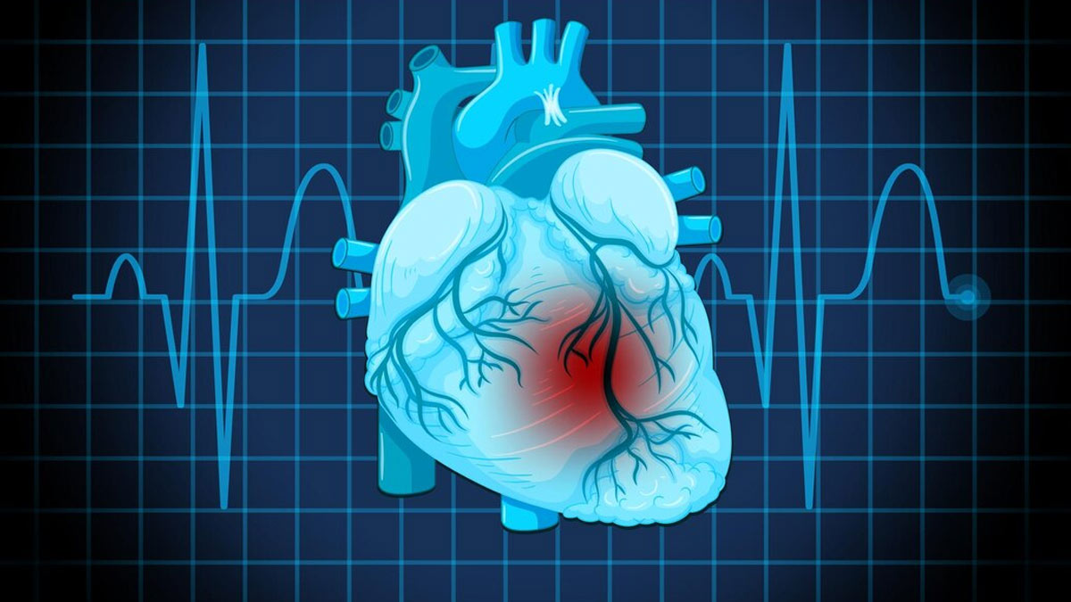 When Should You Take Heart Palpitations Seriously Warning Signs
