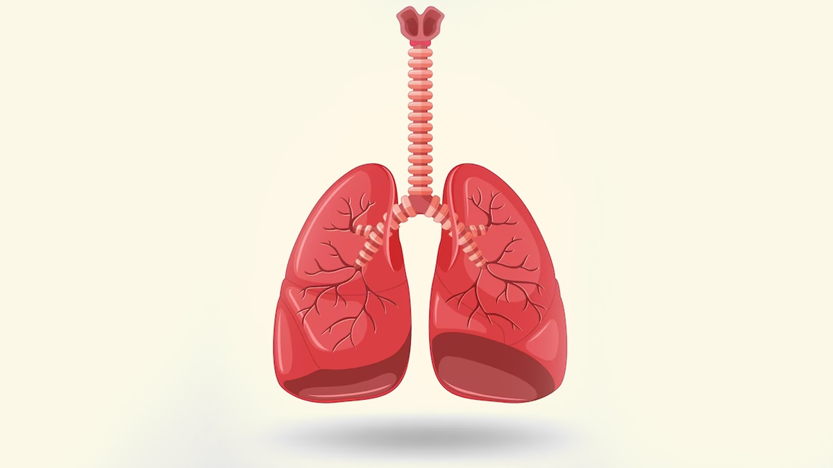 What Are The Types Of Lung Cancer Here Are Some Differences And Treatment Options Onlymyhealth