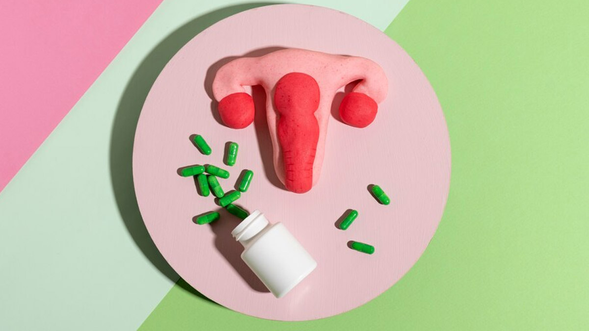 How To Treat Pcos Without Birth Control Pills Onlymyhealth