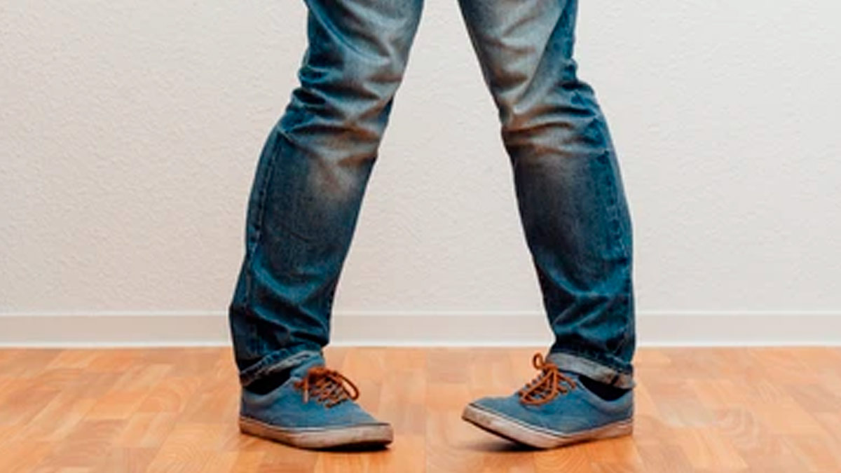 What Are Knock Knees? Doctor Explains Causes | OnlyMyHealth