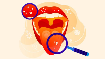 Causes Of Sour Taste In The Mouth | Onlymyhealth