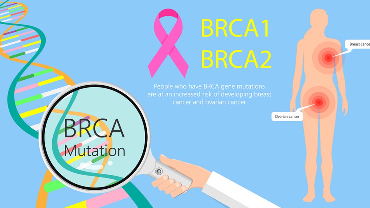 What Is BRCA Gene Mutation When And Who Should Get Tested For It