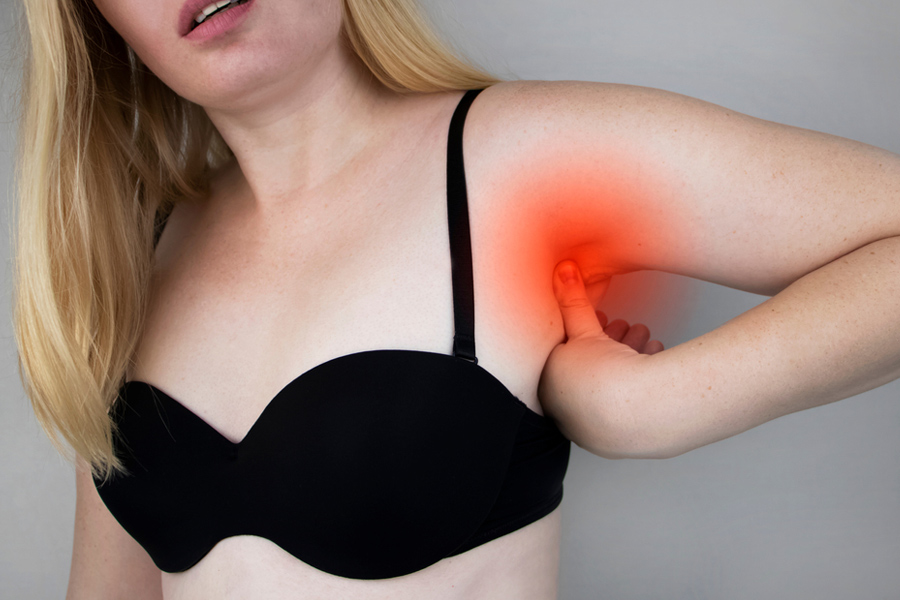 An Armpit Lump Doesnt Necessarily Mean Cancer Know Other Possible Causes Onlymyhealth