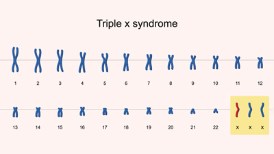 Health Diseases: Causes, Symptoms, Treatment