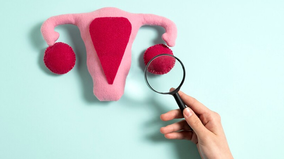 Blocked Fallopian Tubes And Infertility: What You Need to Know ...