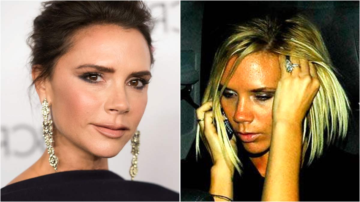 Here’s How Victoria Beckham Got Rid of Her Acne: Skincare Practices ...