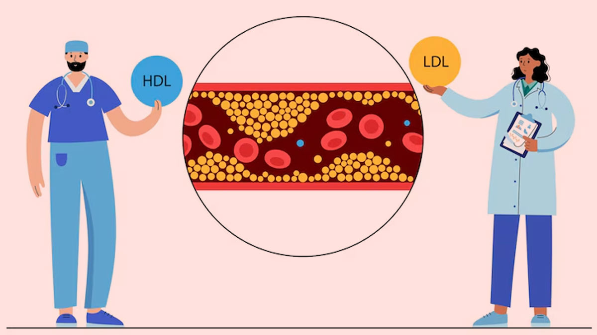 Cholesterol And Hormones: Why Women Need To Pay Attention | OnlyMyHealth