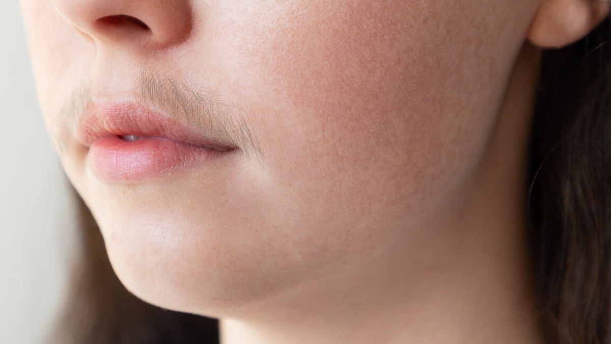 How Can Women Know If Hair Growth On Their Face And Body Is Normal Or ...