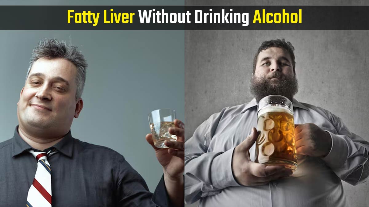 How You Might Have a Fatty Liver Even If You Don’t Drink Alcohol: Liver ...