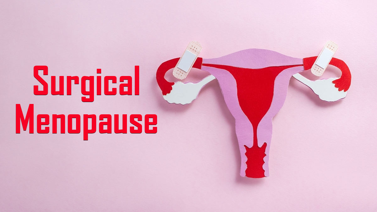 Surgical Menopause Explained: A Guide To Symptoms, Treatments And ...