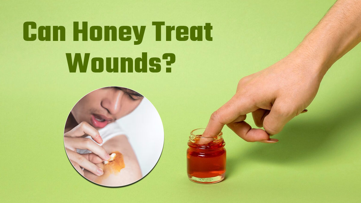 Can Honey Treat Wounds? Expert Shares The Science Behind Its Antibiotic ...